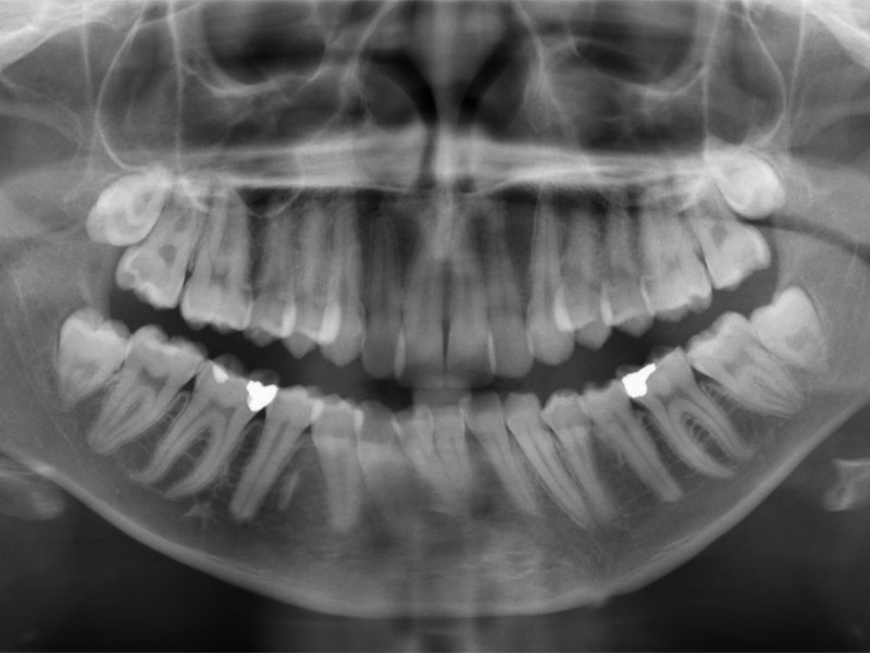Malaysia Smile | X-Ray Facilities